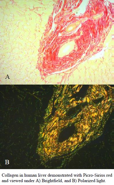 PSR-1 | Picro-Sirius Red Stain Kit (For Collagen) Biotrend